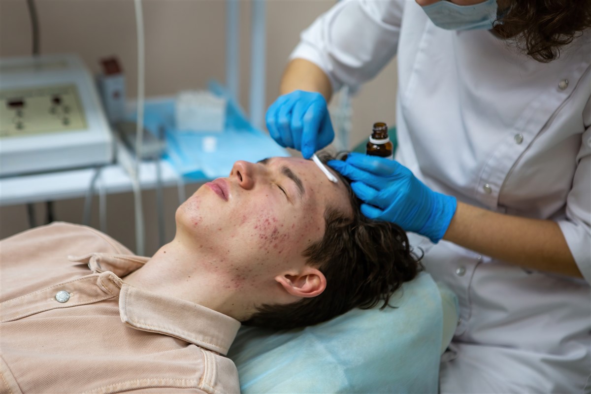Comment traiter efficacement les boutons d'acné sur le cuir chevelu ...